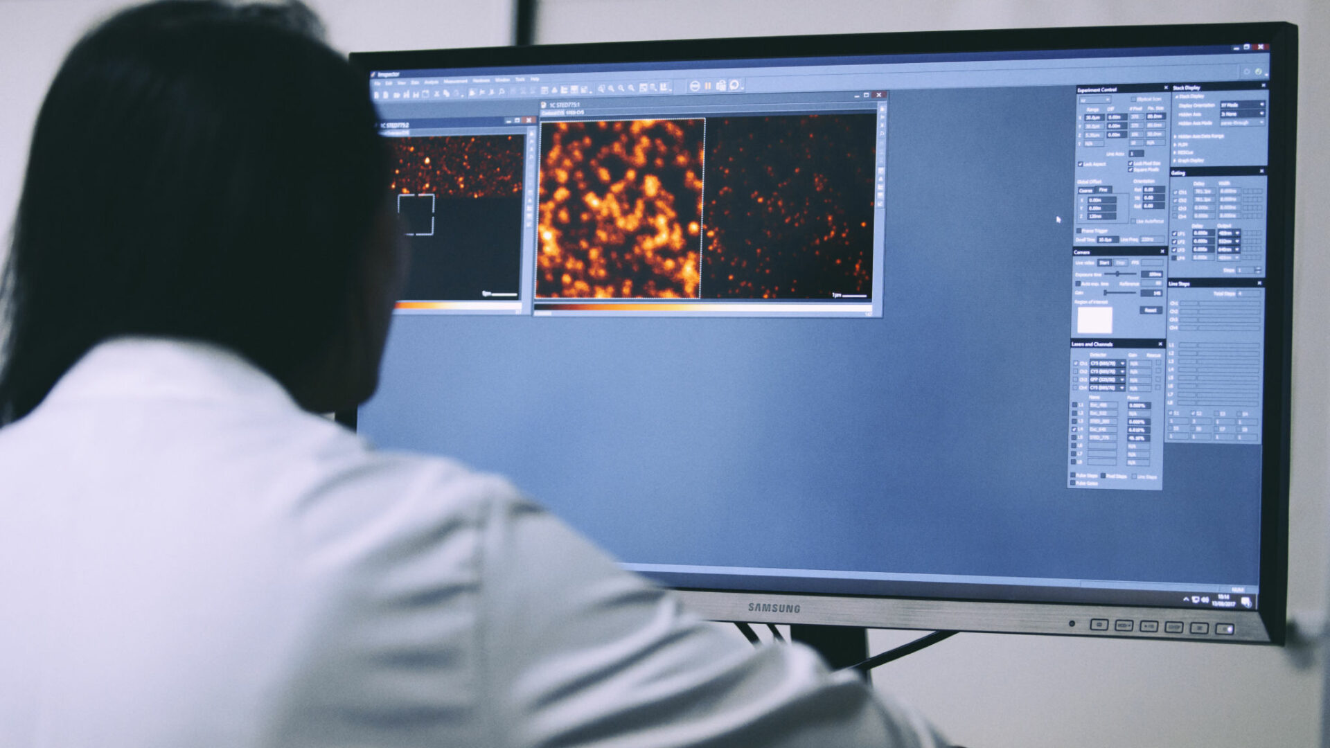 Biomedical Imaging | Åbo Akademi University